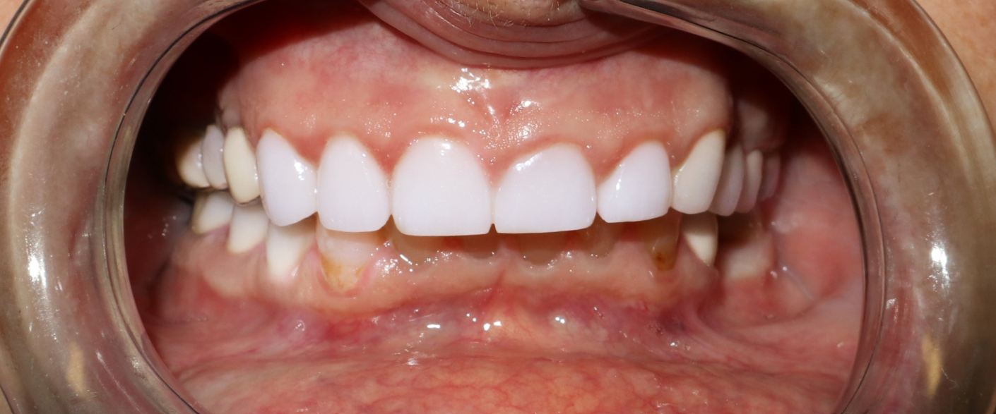 Smile Gallery – Anoush Yessaian DDS